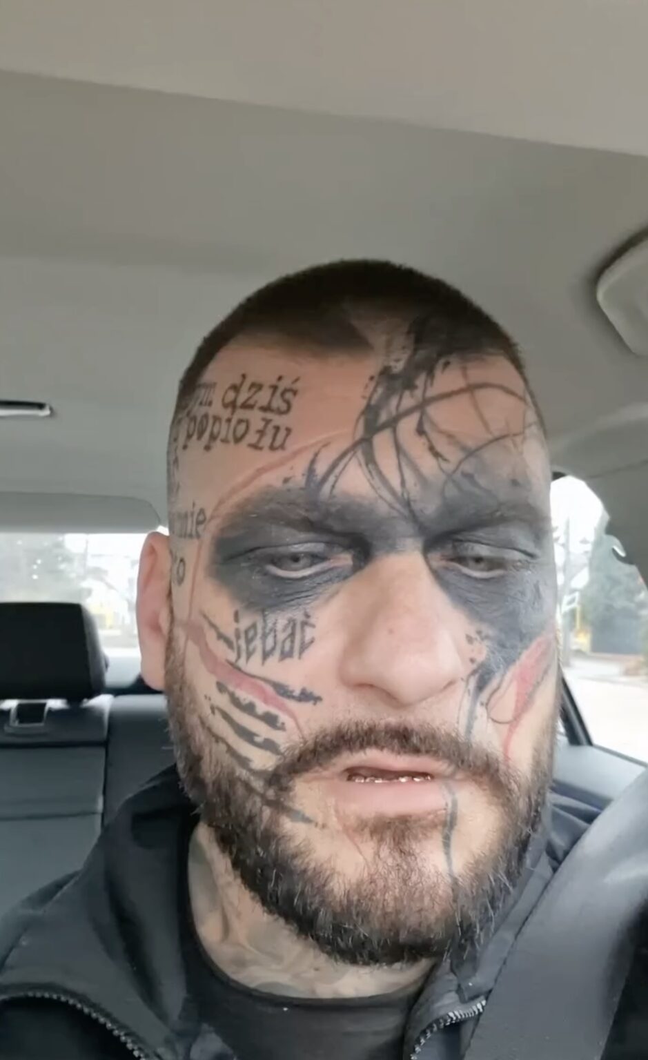 Rapper undergoes ‘extremely painful’ procedure to remove face tattoos ...
