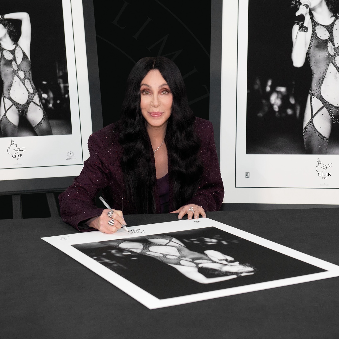 Puzzled woman finds face of Cher in bruise on knee - What's The Jam