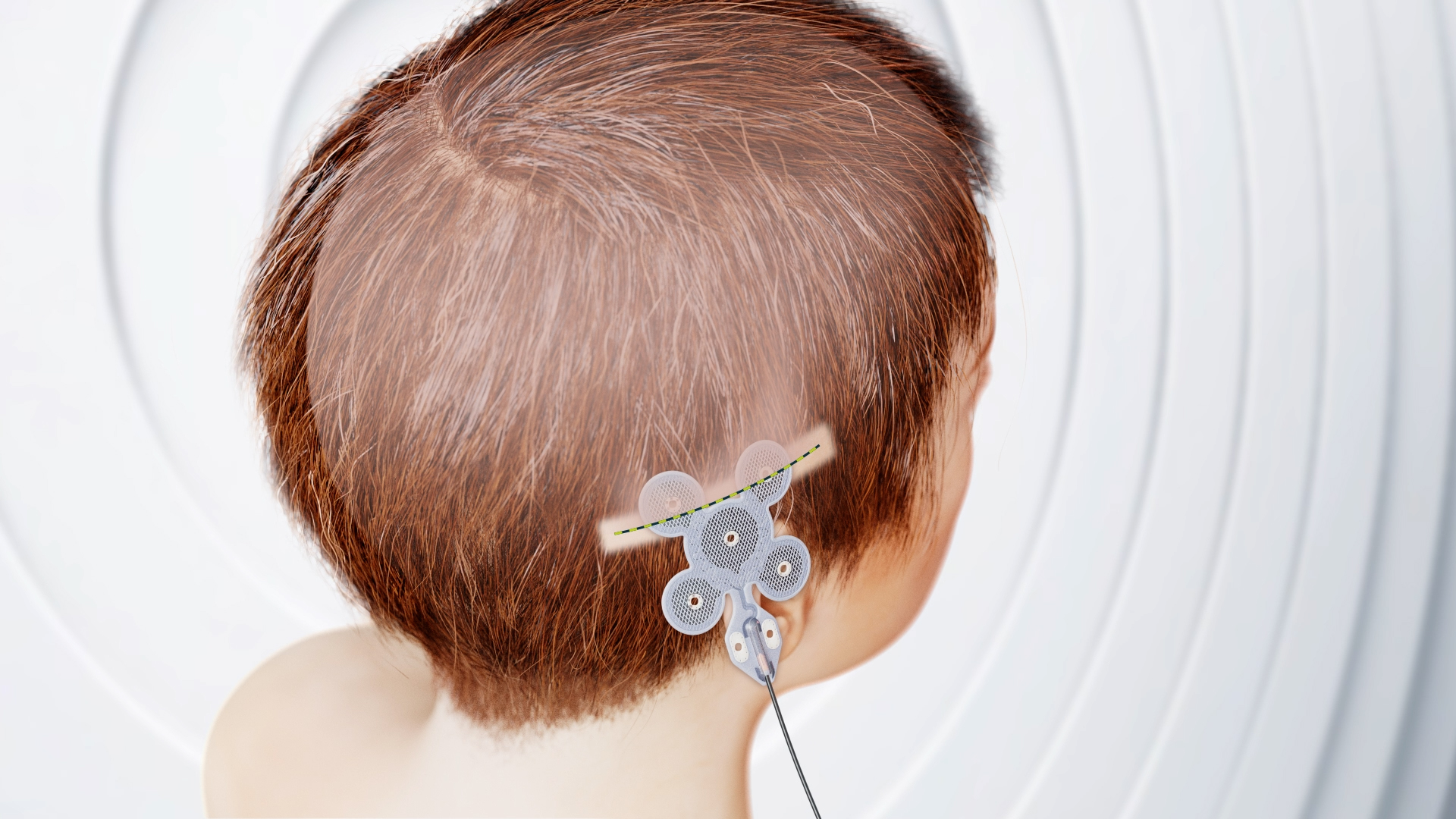 Patient fitted with UK’s first ever pacemaker for the brain to treat ...