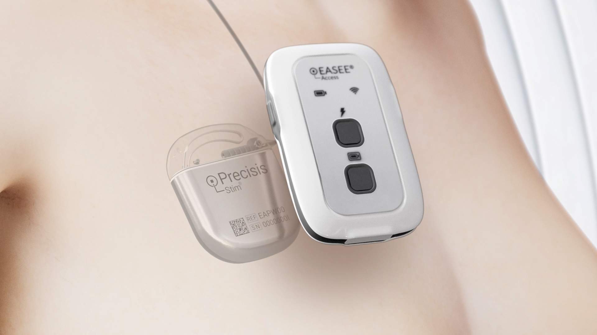 Patient fitted with UK’s first ever pacemaker for the brain to treat ...